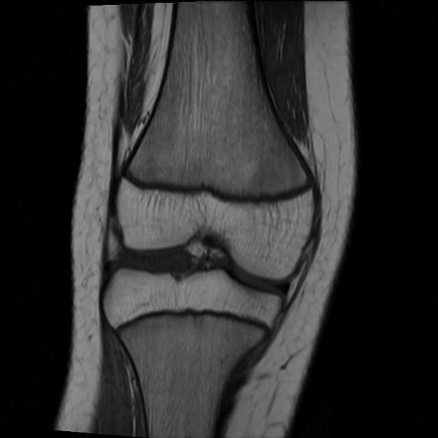 Question 4943 - Qbank - Orthobullets