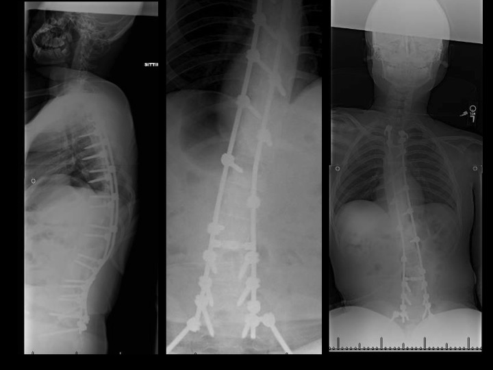 Question 4991 - Qbank - Orthobullets