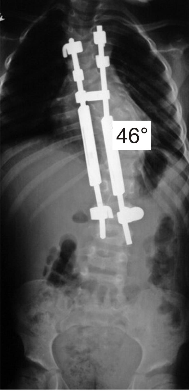 Question 5007 - Qbank - Orthobullets
