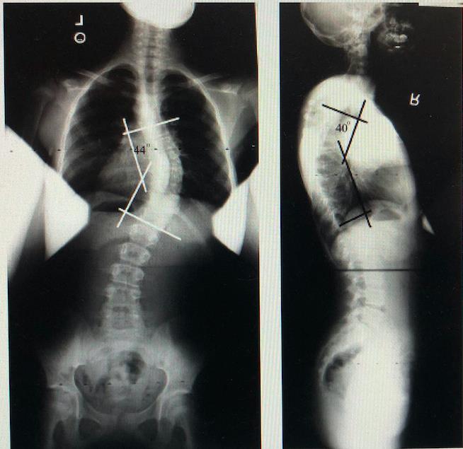 Question 5107 - Qbank - Orthobullets