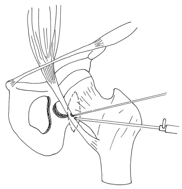 Question 5413 - Qbank - Orthobullets