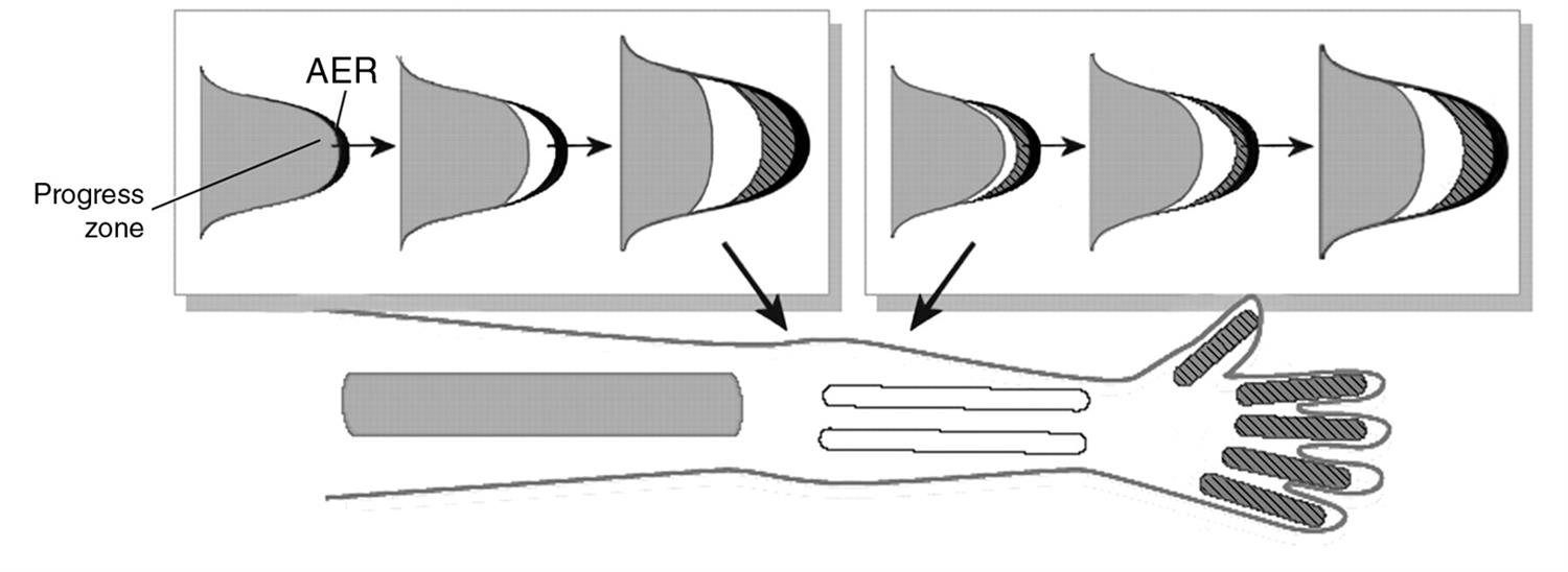 Question 5419 - Qbank - Orthobullets