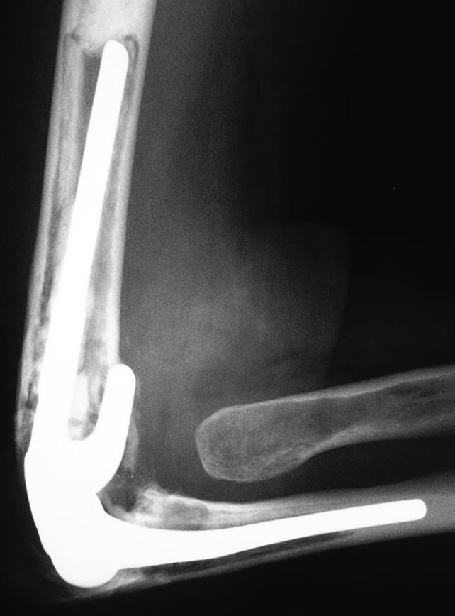 Question 5422 - Qbank - Orthobullets