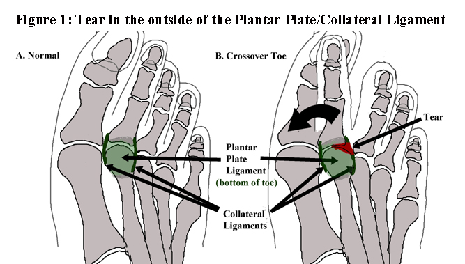 Question 5456 - Qbank - Orthobullets