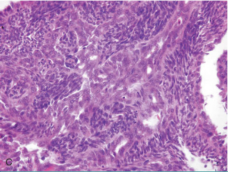 Question 5470 - Qbank - Orthobullets