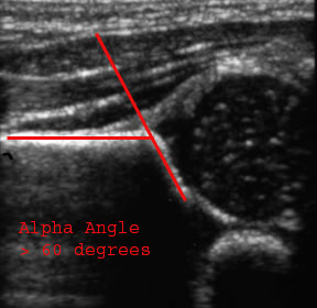 Question 5532 - Qbank - Orthobullets