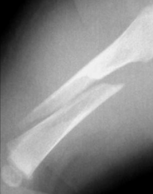 Question 5572 - Qbank - Orthobullets