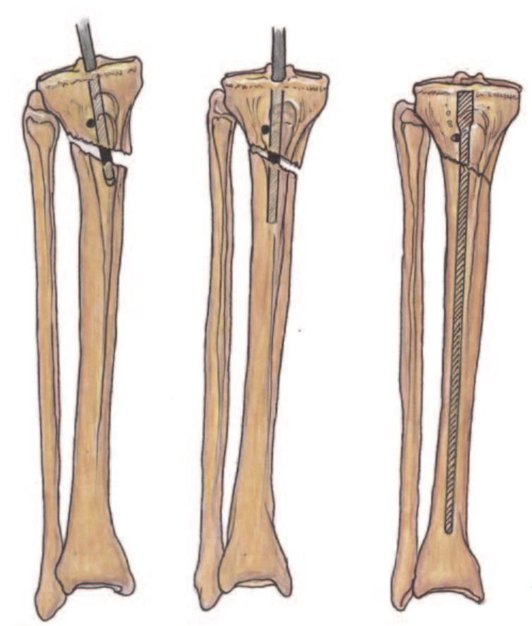 Question 5618 - Qbank - Orthobullets