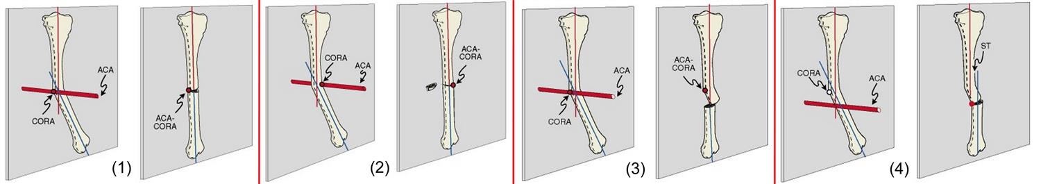 Question 5629 - Qbank - Orthobullets