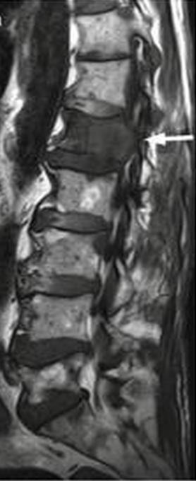 Question 5643 - Qbank - Orthobullets