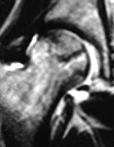 Question 5674 - Qbank - Orthobullets