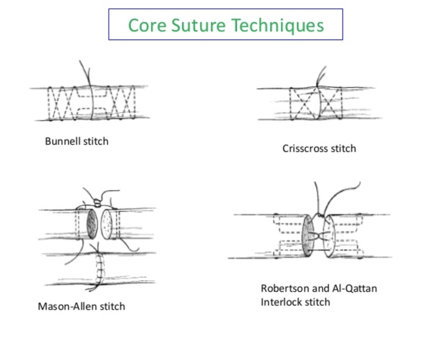 Question 5713 - Qbank - Orthobullets