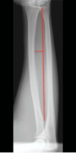 Question 5824 - Qbank - Orthobullets