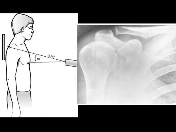 Shoulder Imaging - Shoulder & Elbow - Orthobullets