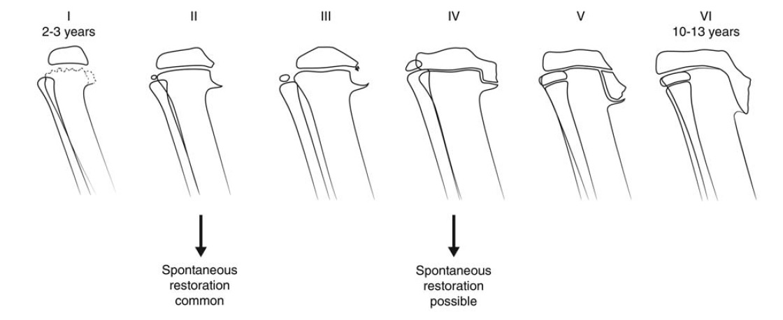 Question 218231 - Qbank - Orthobullets