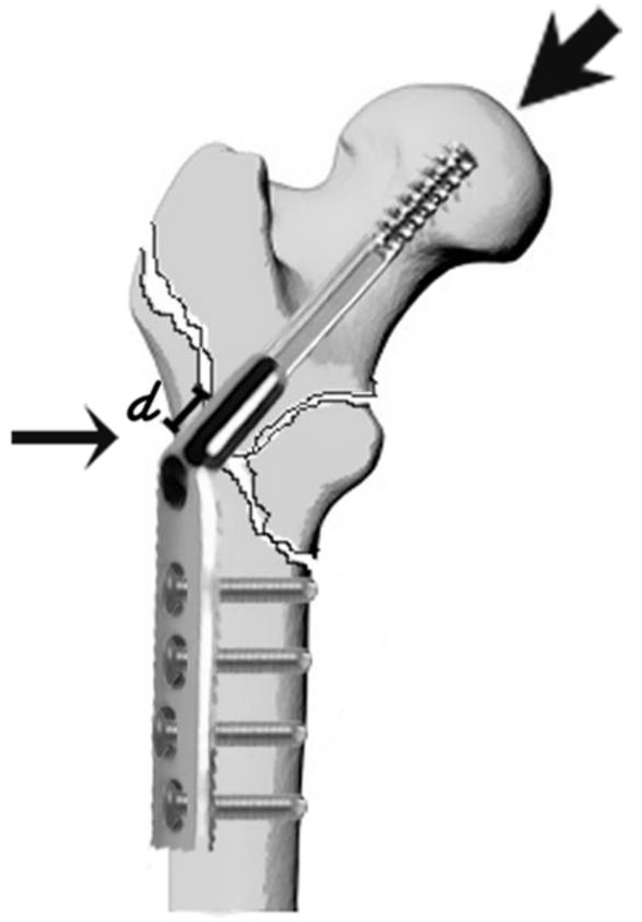 Question 5903 - Qbank - Orthobullets
