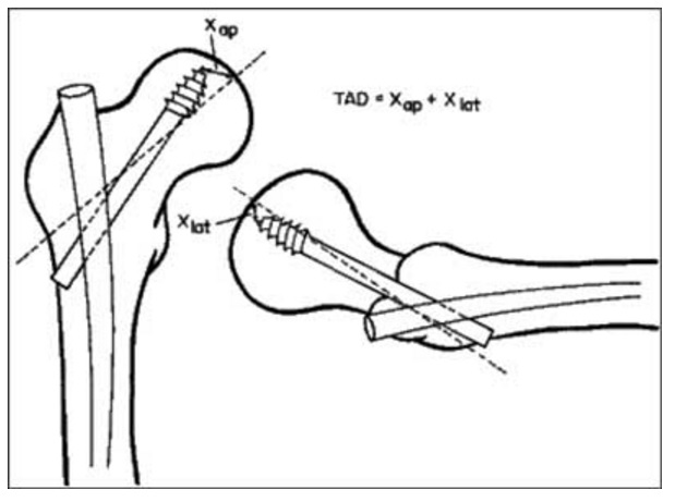 Question 5903 - Qbank - Orthobullets