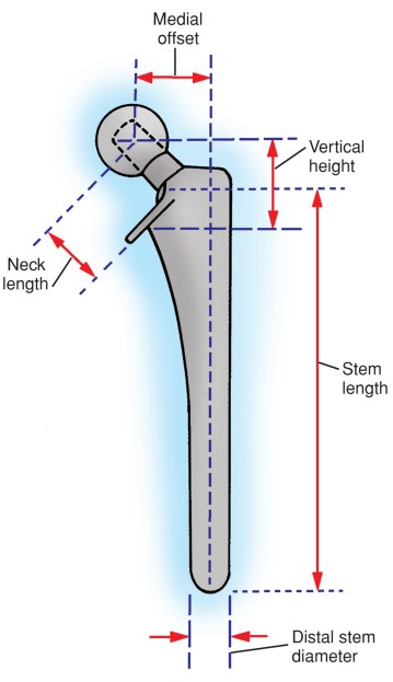 Question 5923 - Qbank - Orthobullets