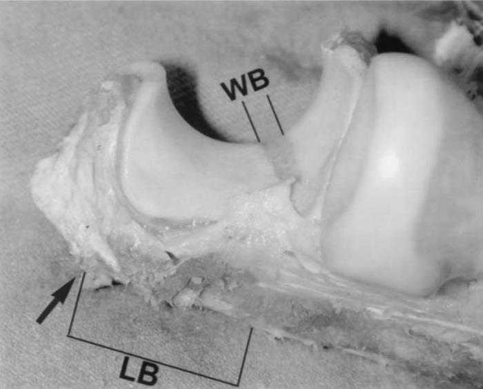 Question 5944 - Qbank - Orthobullets