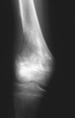 Other Pathology Topics - Pathology - Orthobullets