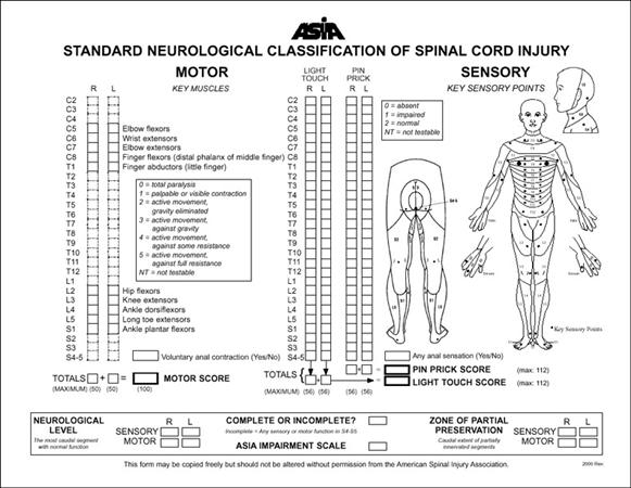 Lumbar Disc Herniation - Spine - Orthobullets