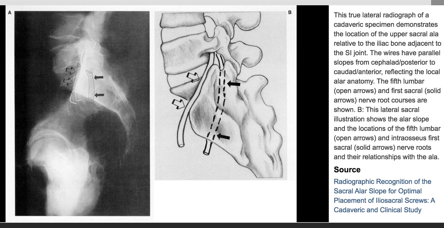 Question 6922 - Qbank - Orthobullets