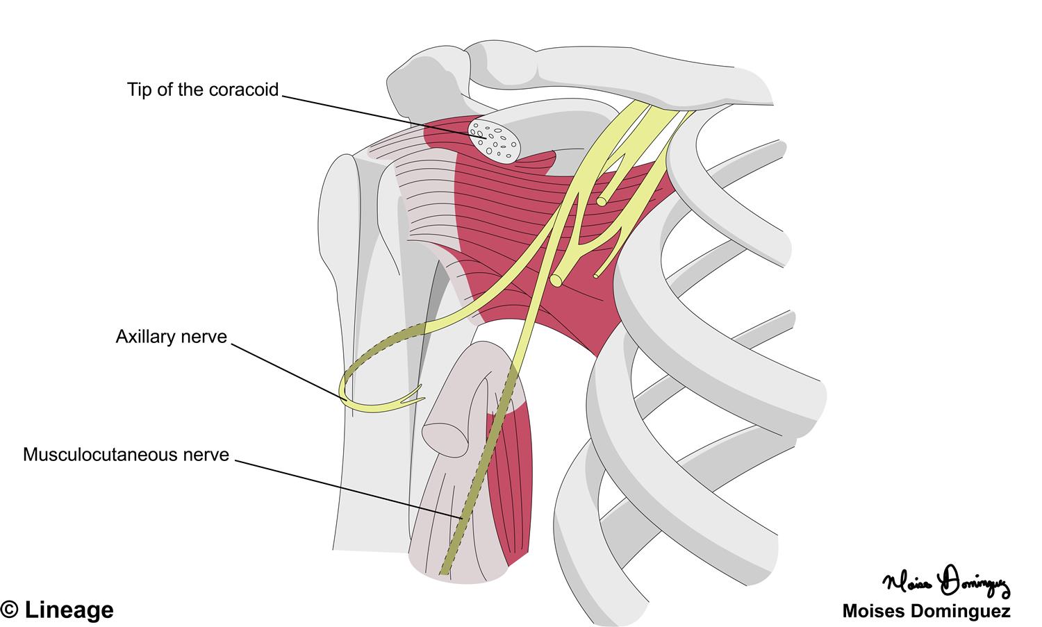 Question 214994 - Qbank - Orthobullets