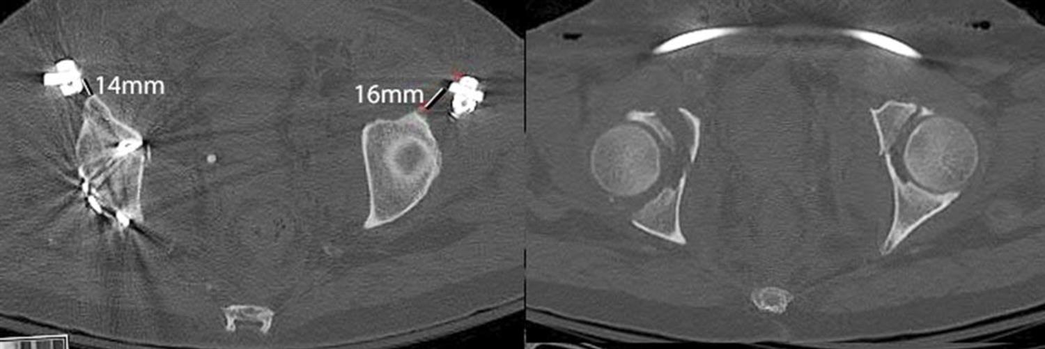 Question 8776 - Qbank - Orthobullets