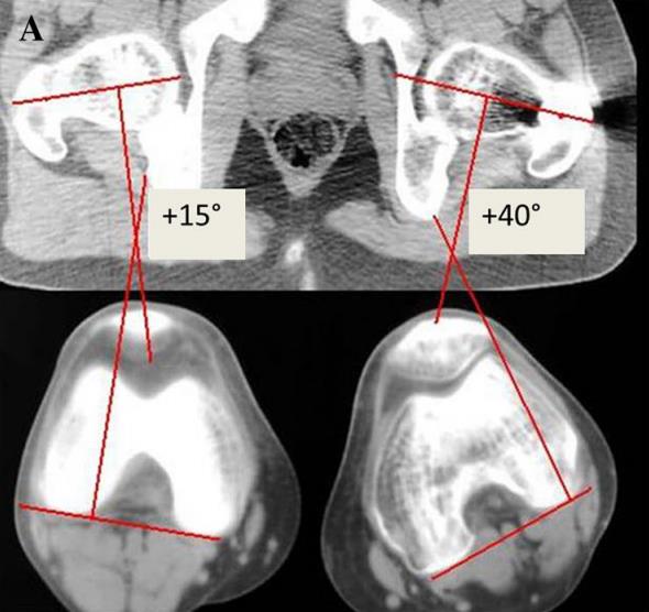 Question 8780 - Qbank - Orthobullets