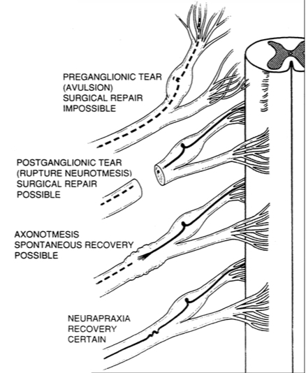 Question 8795 - Qbank - Orthobullets