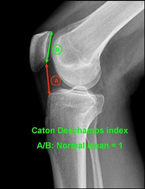 Question 8813 - Qbank - Orthobullets