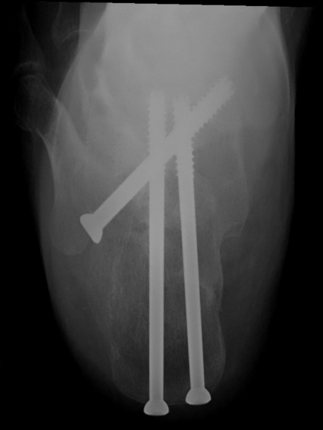 Question 8855 - Qbank - Orthobullets