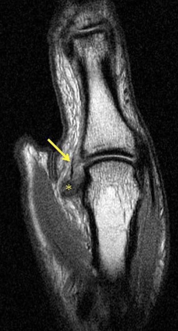 Question 8902 - Qbank - Orthobullets