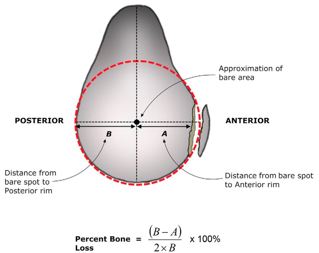 Question 8947 - Qbank - Orthobullets