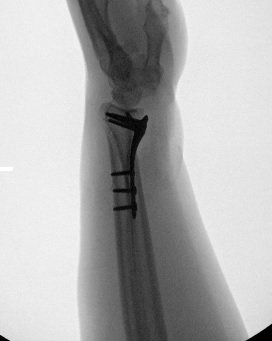 Question 8990 - Qbank - Orthobullets