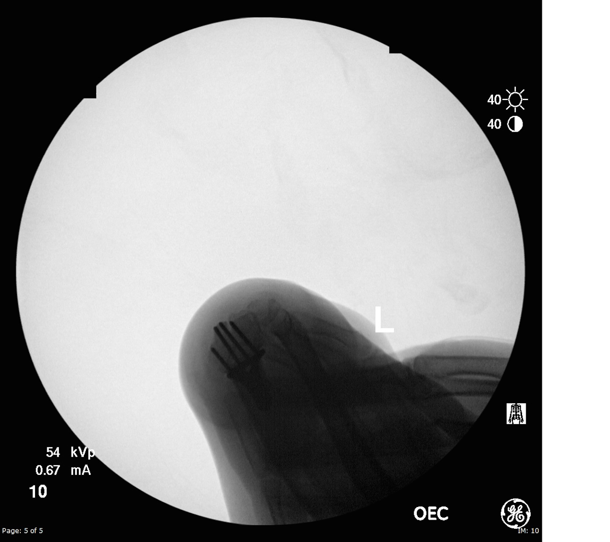 Question 8990 - Qbank - Orthobullets