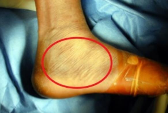 Question 9028 - Qbank - Orthobullets