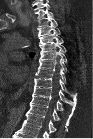 Question 9101 - Qbank - Orthobullets