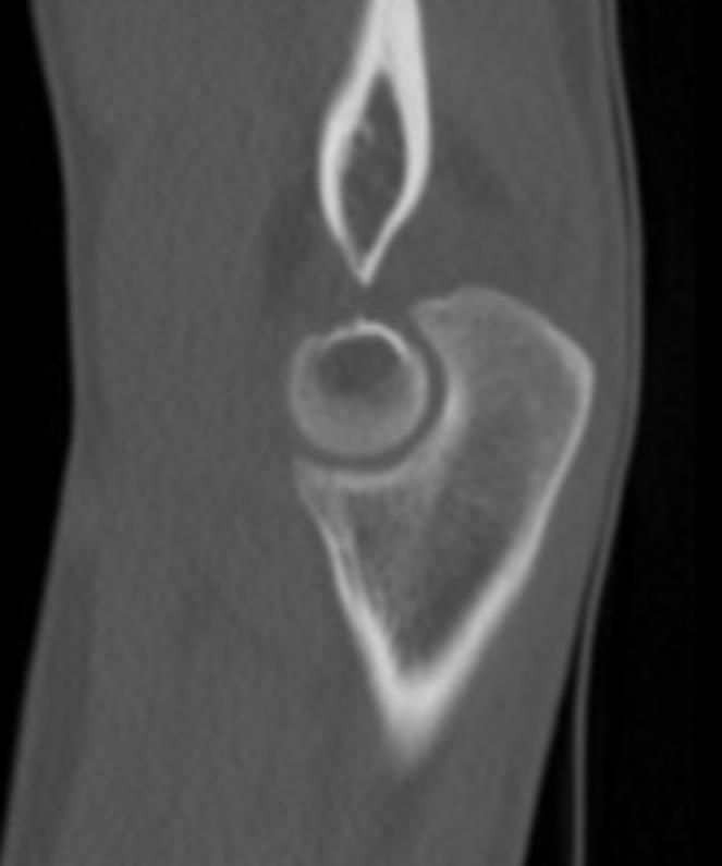 Question 9113 - Qbank - Orthobullets