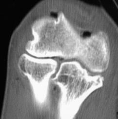 Question 9113 - Qbank - Orthobullets