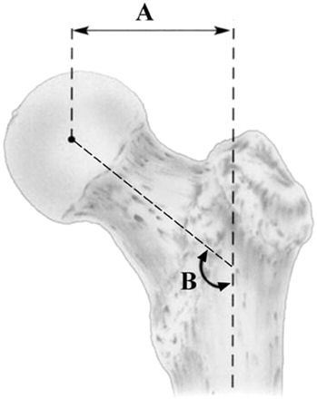 Question 995 - Qbank - Orthobullets