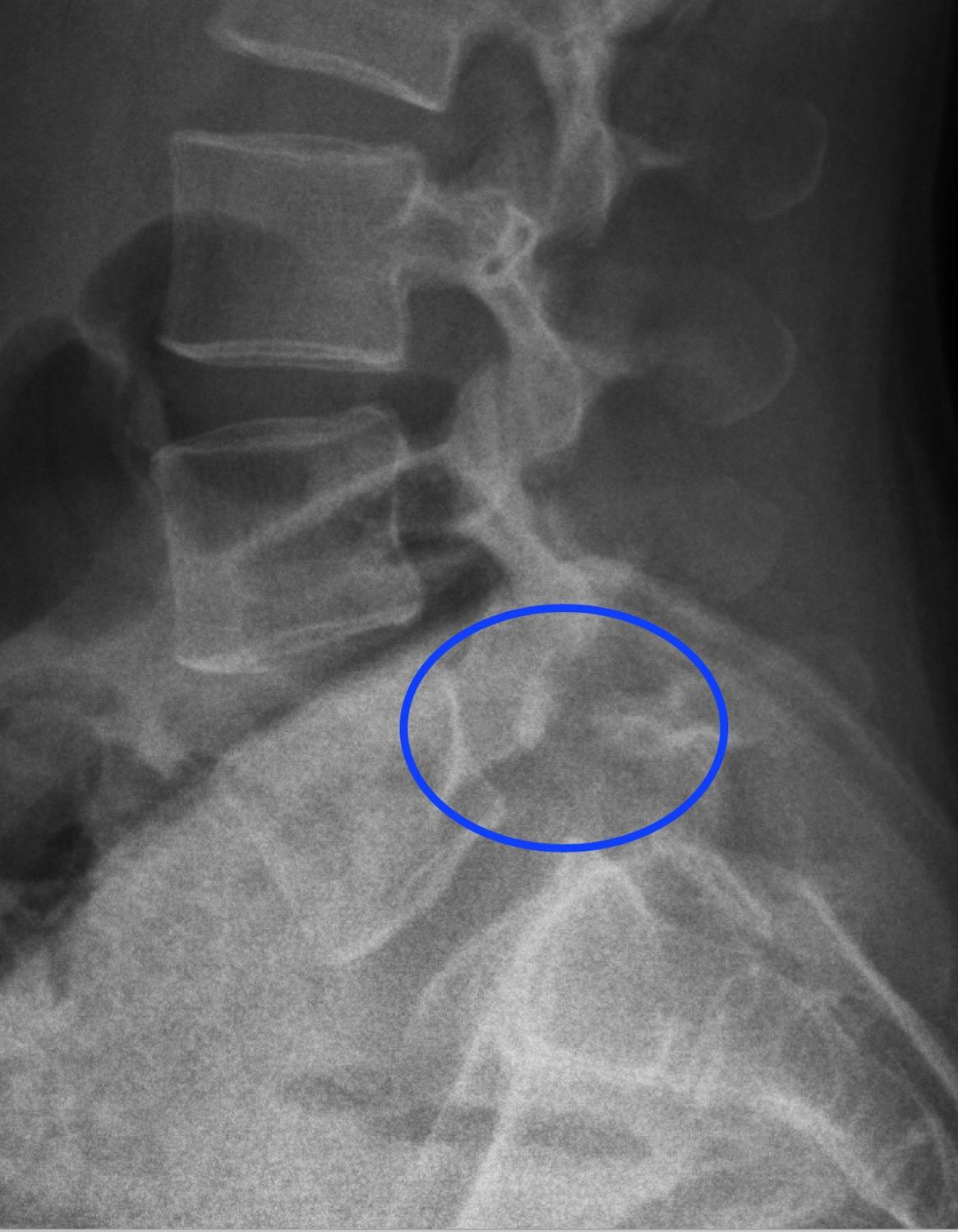 Question 998 - Qbank - Orthobullets