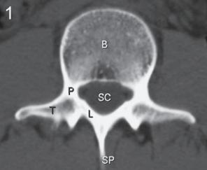 Spine Biomechanics - Spine - Orthobullets