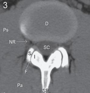 Spine Biomechanics - Spine - Orthobullets