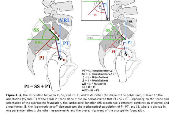 Adult Isthmic Spondylolisthesis - Spine - Orthobullets