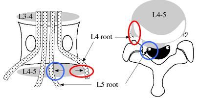 Lumbar Spine Anatomy - Spine - Orthobullets