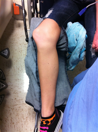 History and Physical Exam of the Knee - Knee & Sports - Orthobullets