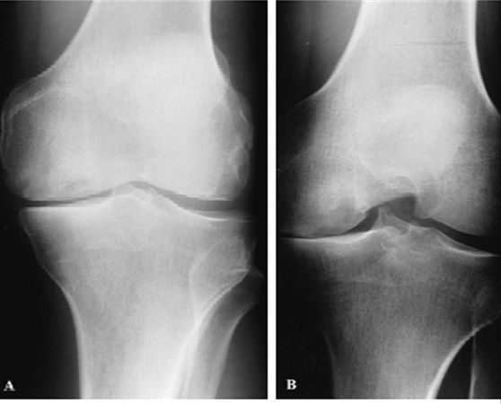 Knee Imaging - Knee & Sports - Orthobullets