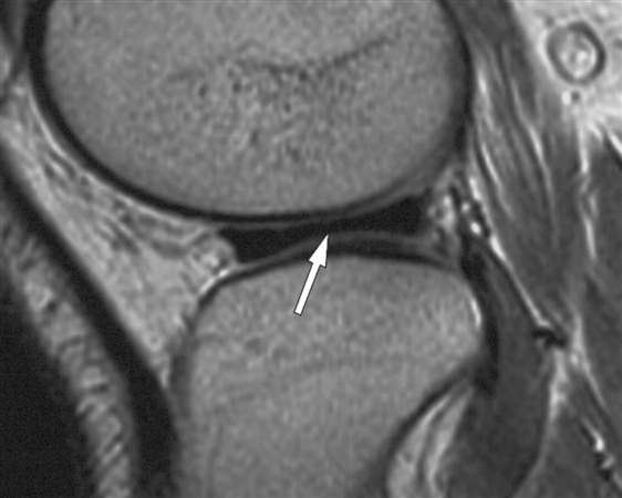 Knee Imaging - Knee & Sports - Orthobullets
