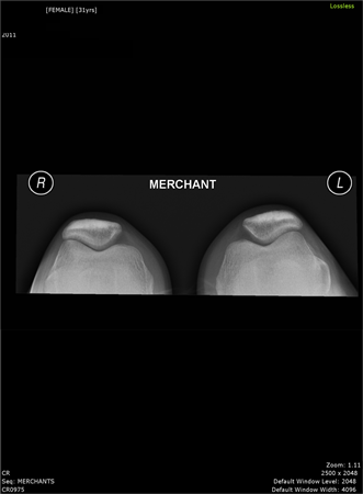 Knee Imaging - Knee & Sports - Orthobullets